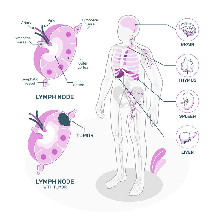 Signs of a Clogged Lymphatic System – Alkaline Herb Shop